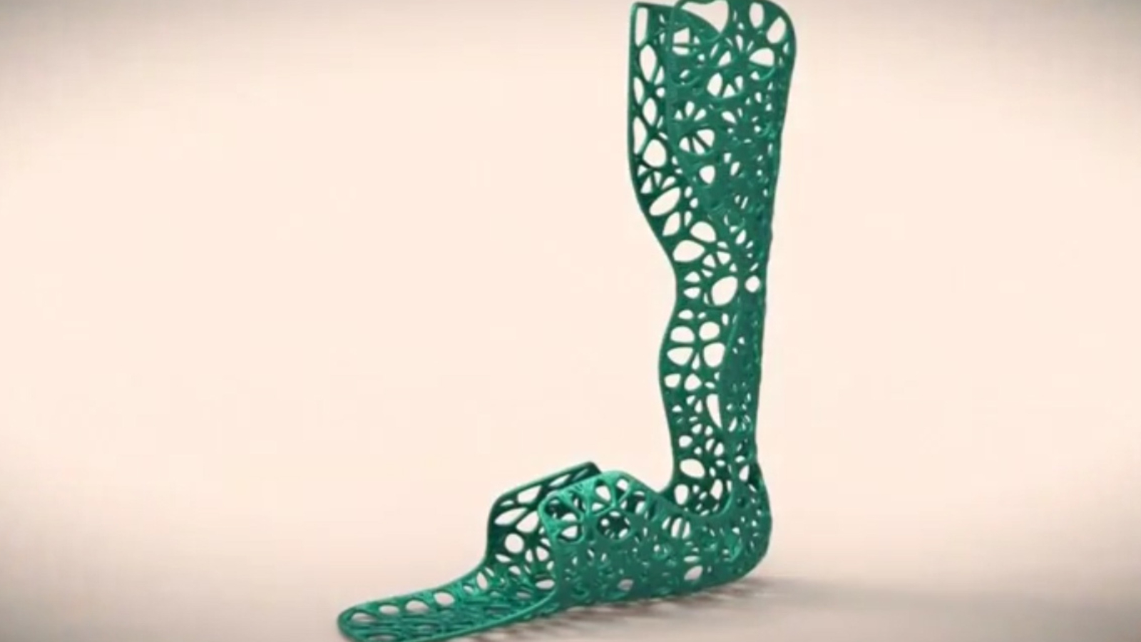 Orthesen aus dem 3D-Drucker