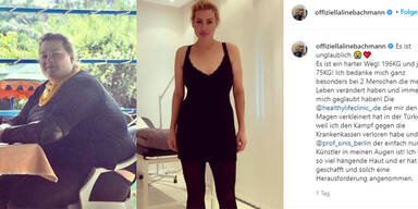 Ex-DSDS-Kandidatin nimmt 121 (!) Kilo ab