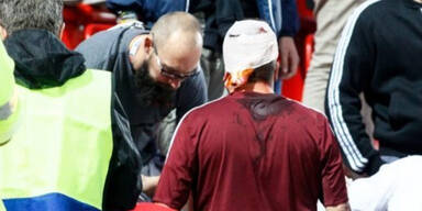Brutale Hooligan-Attacke auf Bayern-Fans - oe24.at
