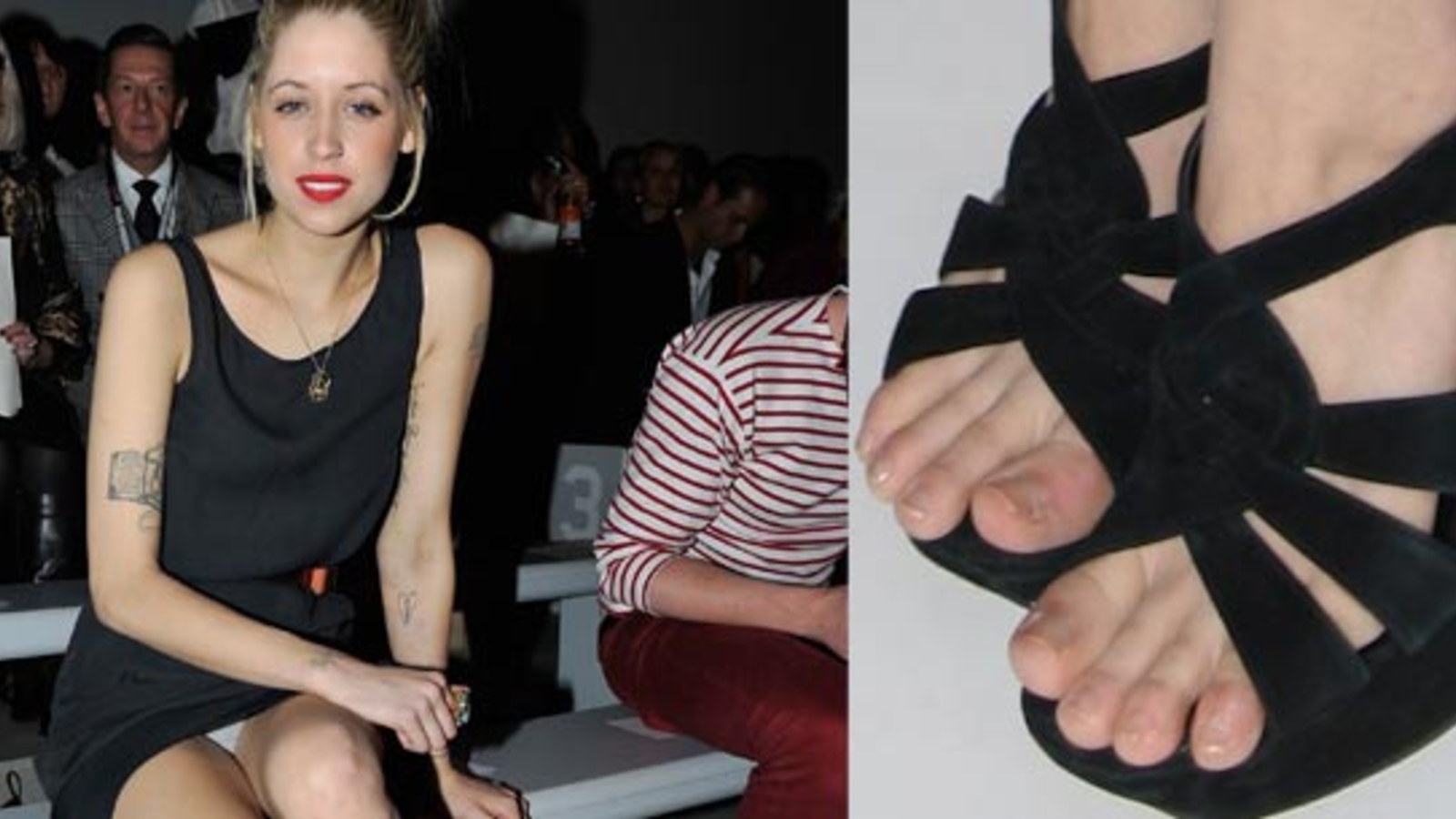 Peaches Geldof: Höschenblitzer & Gruselzehen