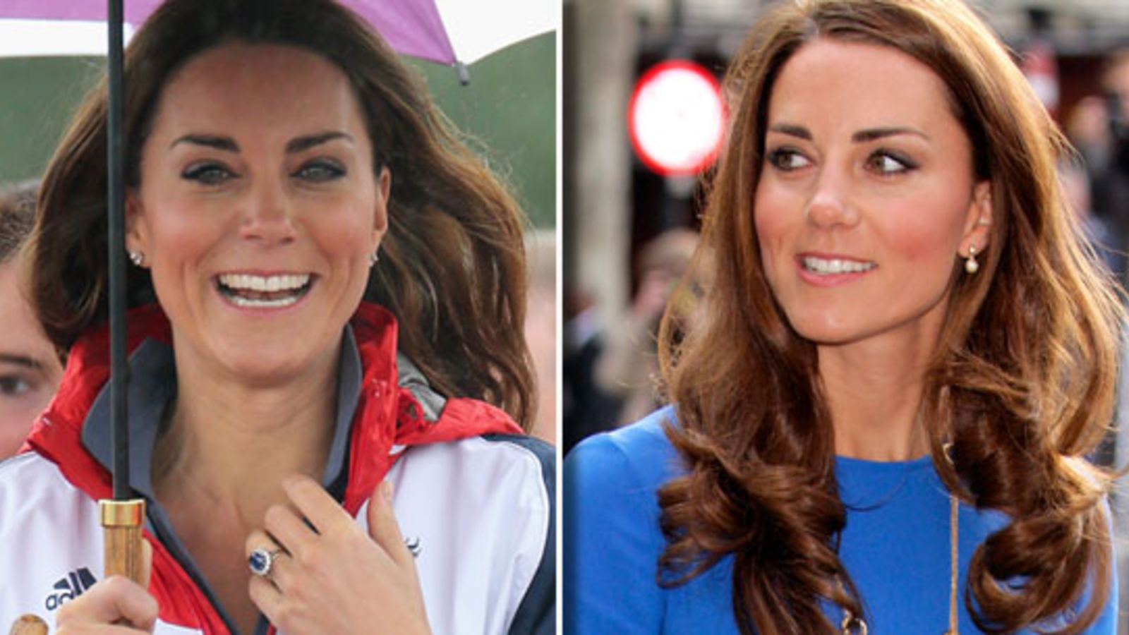 Herzogin Kate Middleton: Botox-süchtig?
