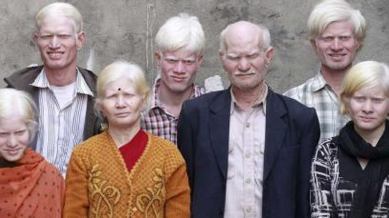 Das ist die größte Albino-Familie der Welt