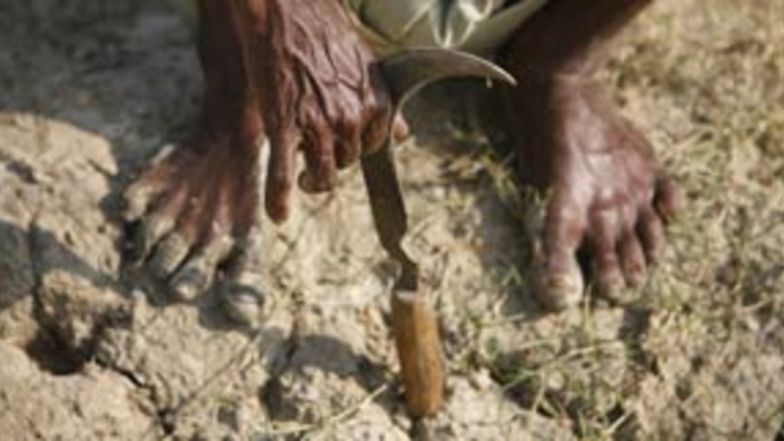 Selbsternanntem Heiligen in Indien Bein abgehackt